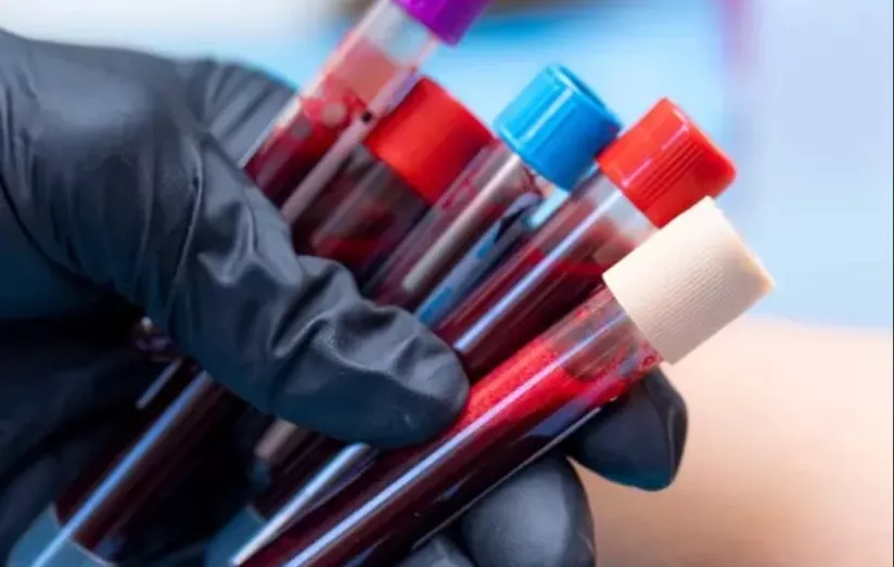 Επιστήμονες αναγνώρισαν νέα ομάδα αίματος- Λύθηκε ένα μυστήριο 50 ετών | xronos.gr